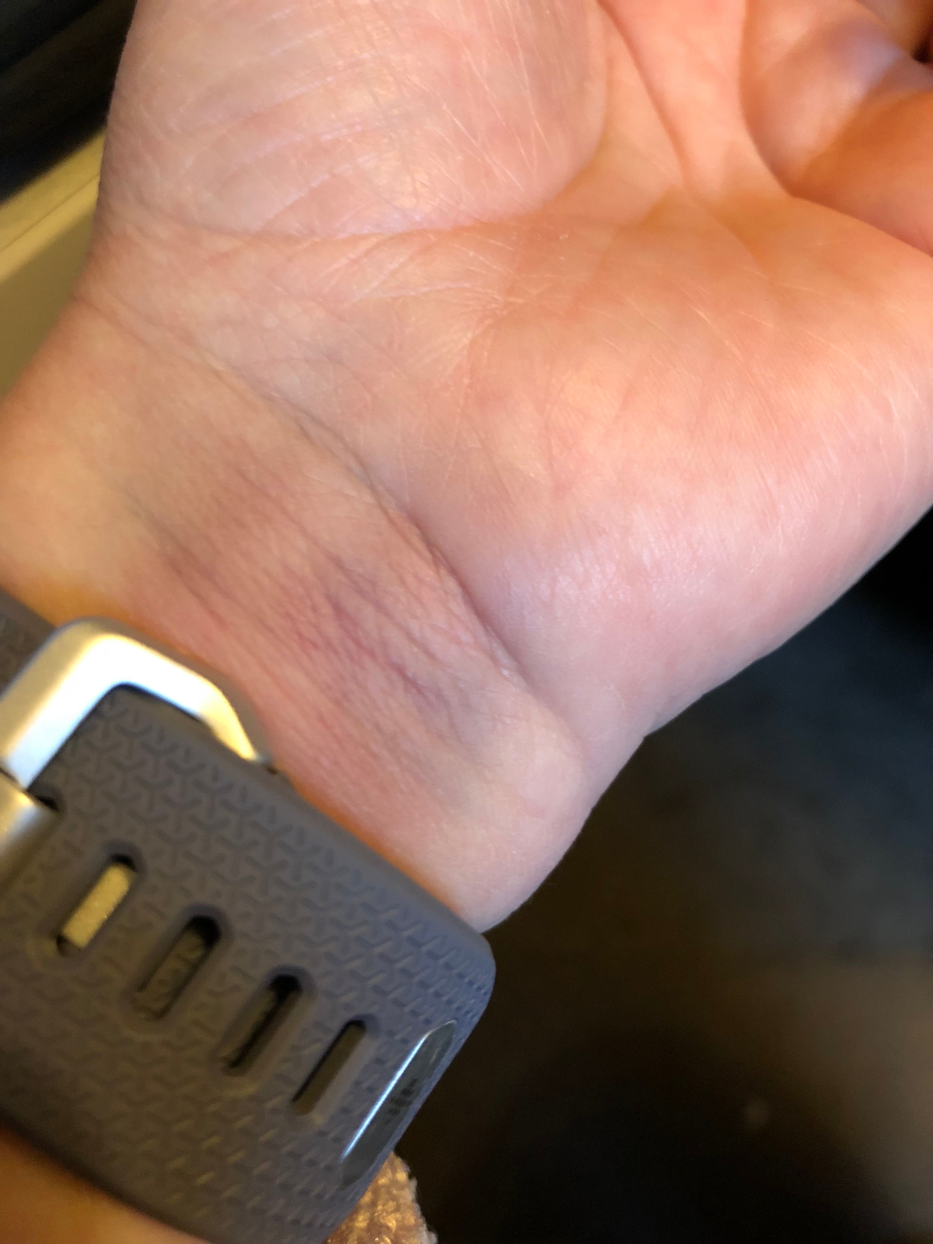 Roller derby - Fitbit Community